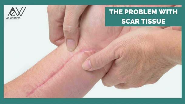 The Problem with Scar Tissue - AE Wellness